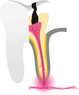 Endodontologie