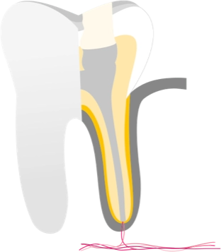 Endodontologie
